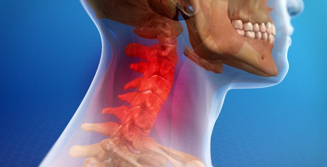 Signs and Symptoms of Whiplash Injuries | El Paso, TX Chiropractor