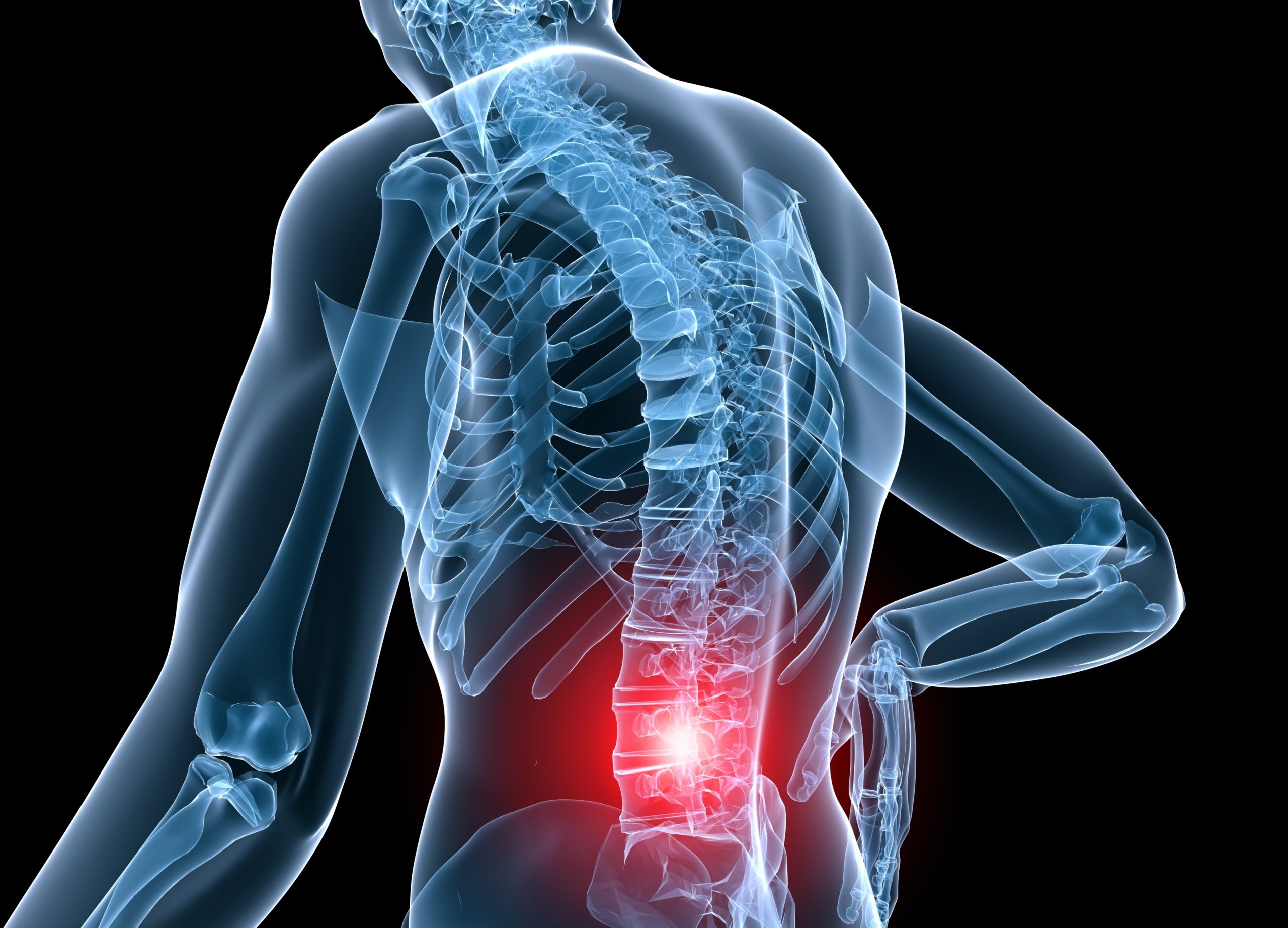 A Cost-Effective Treatment For Lumbosacral Pain - EP Wellness ...