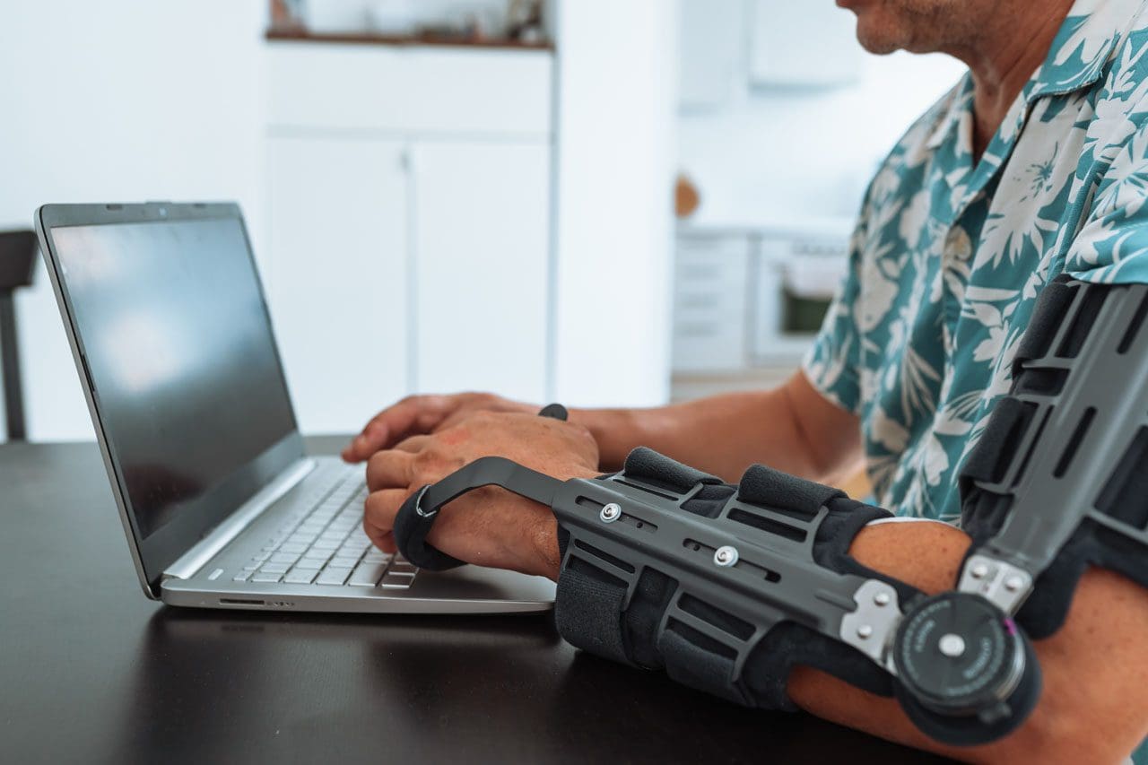 Recovering from Elbow Dislocation - Step-by-Step Guide - EP Wellness ...